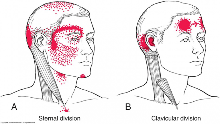 Neuromuscular Therapy for Temporomandibular Joint Disorders and ...