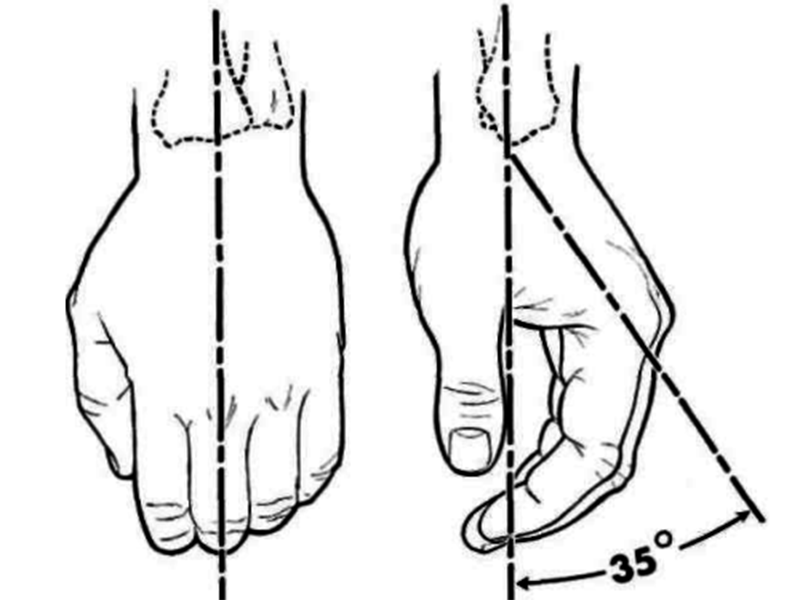 “Massage Therapist Thumb” from a Neuromuscular Therapy Perspective ...